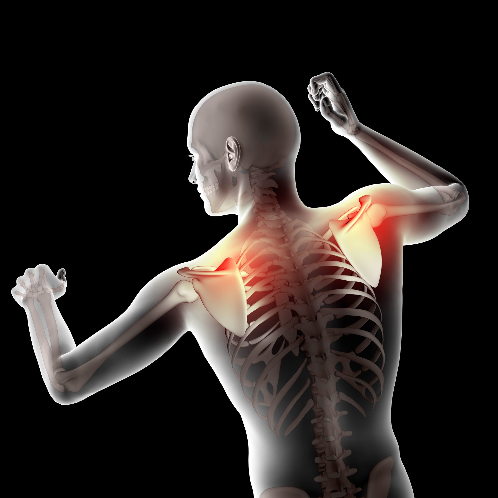 7 Rawatan Fisioterapi Effective Untuk Frozen Shoulder: Pulihkan ...